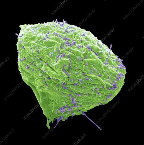 Avian Flu Sem Stock Image C0580785 Science Photo Library