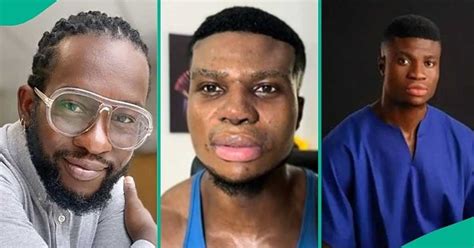 Nigerian Man Reacts As Zicsaloma Displays His New Face 3 Weeks After