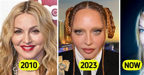 Madonnas Face Then And Now