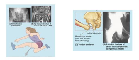 Clinical Correlations Unit 2 Flashcards Quizlet