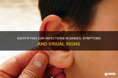 Identifying Ear Infections In Babies Symptoms And Visual Signs Medshun