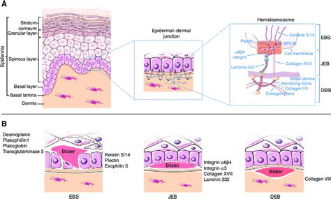 Schematic Representation Of Human Skin And Epidermolysis Bullosa Eb