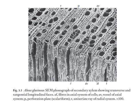 Secondary Xylem Construction Structure Of Xylem