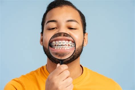 Spotlight On Braces For Midline Misalignment Soleil Orthodontics