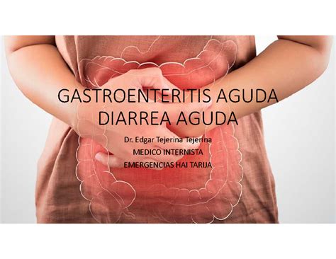 Gastroenteritis Aguda Gastroenteritis Aguda Diarrea Aguda Dr Edgar