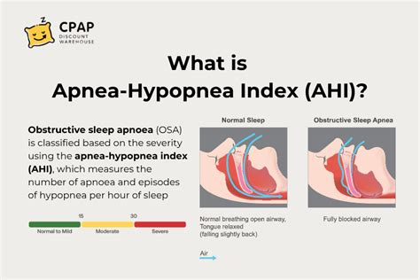 Apnea Hypopnea Index Ahi What Is It Meaning Results