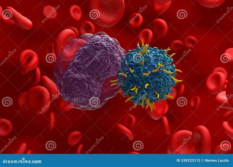 Non Hodgkin Is Lymphoma In Lymph Node Stock Image 281924035