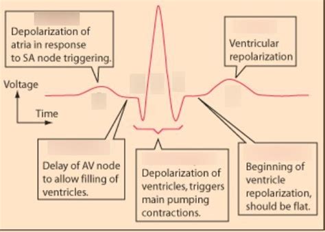 Ekg Graph Diagram Quizlet