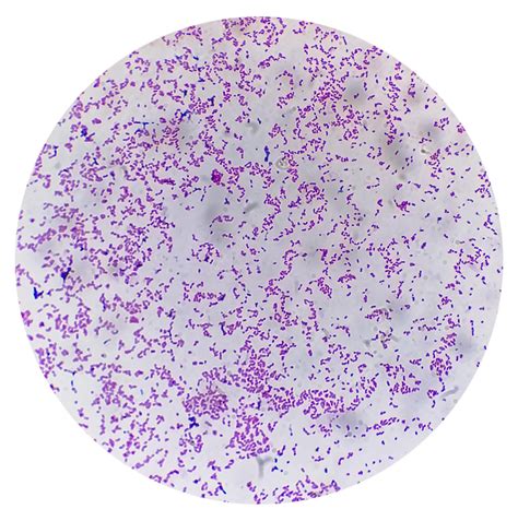 Premium Photo Gram Staining Also Known As Grams Method Is A Method Of Differentiating