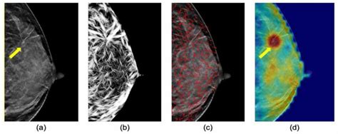 Example Of Ad In A Slice Of Dbt Volume A Original Slice Of Dbt The