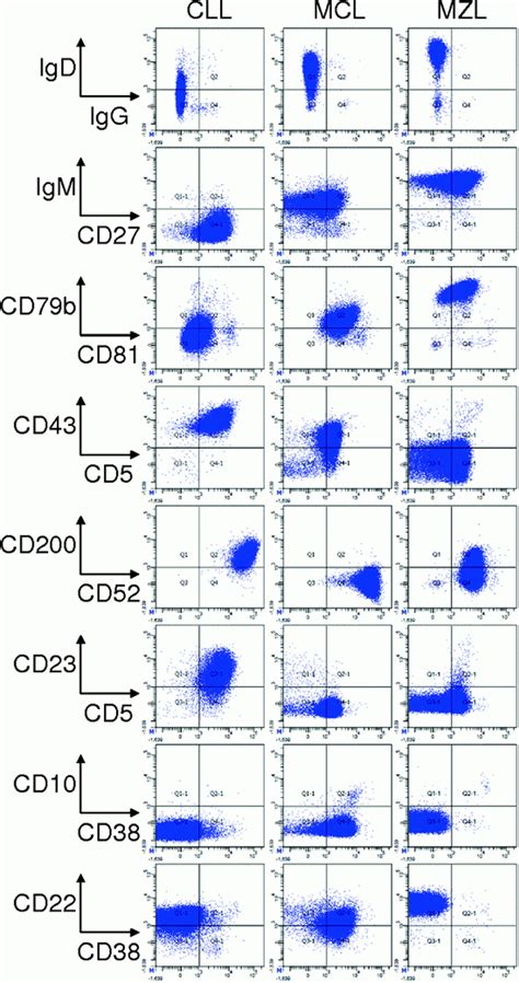 Histopathology Morphology And Immunophenotyping Of Cll Oncohema Key