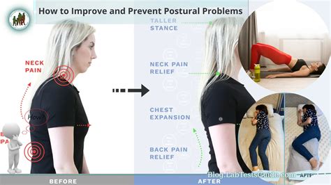 How To Improve And Prevent Postural Problems Lab Tests Guide Blog