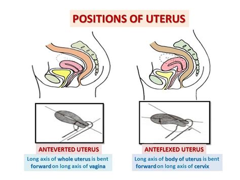 Pin On Gynae Ultrasound