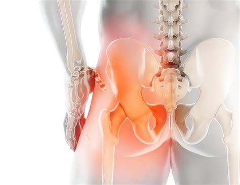 Periacetabular Osteotomy Procedure In Paris And Lyon Inside The Hip