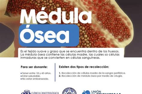 Médula Ósea • Oncólogos Del Occidente Sas Zentria Tratamientos De Cáncer En Armenia