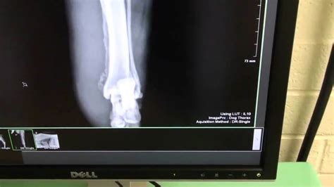 Bone Cancer Or Osteosarcoma In An 8 Year Old Lab Youtube