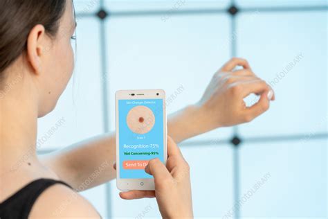 Woman Using Smartphone App To Check Moles Stock Image F Science Photo Library