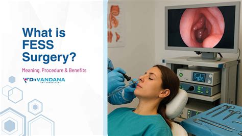 Fess Surgery Meaning Procedure Full Form And Ent Insights Dr