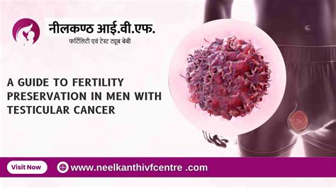 A Guide To Fertility Preservation In Men With Testicular Cancer