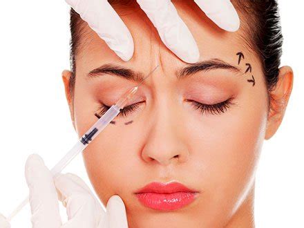 Sculptra ¿qué Es El Tratamiento De Sculptra Dr Cherizola