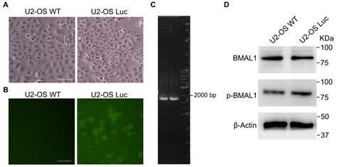 Generation Of Endogenous Promoter Driven Luciferase Reporter System