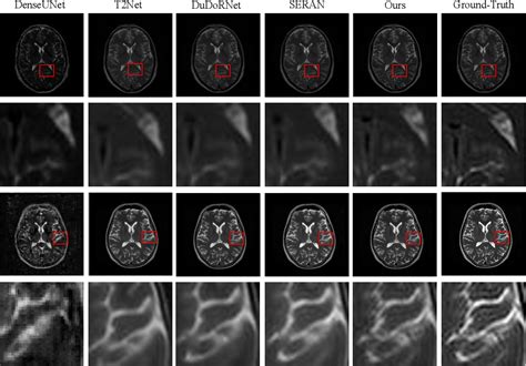 Figure 3 From Multi Contrast High Quality Mr Image Super Resolution With Dual Domain Knowledge