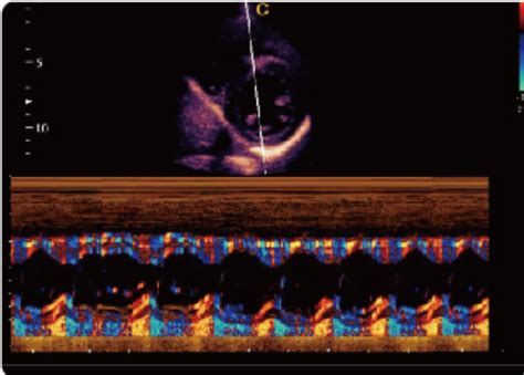 Ecógrafo Chison Qbit 7 Global Ultrasonido