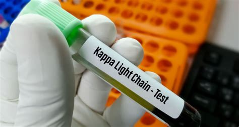 Kappa Or Lambda Better Targets Than Bcma Healthtree For Multiple Myeloma