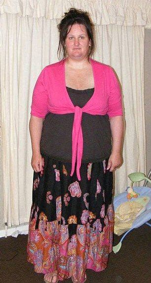 【驚愕】デブ＋ブサイク女性が90kg痩せて100万円で全身整形 ⇒ 結果（画像あり） ポッカキット