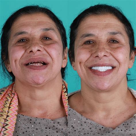 Migraine Vs Cluster Headaches Causes Symptoms And Treatments Vive Hospital