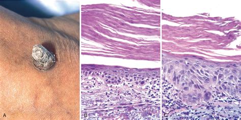 The Skin Clinical Tree