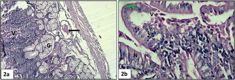 A Duodenum Of Colistin Group Showing Moderate Mucosal Disruption