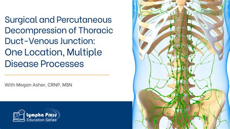 Surgical And Percutaneous Decompression Of Thoracic Duct Venous