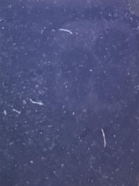 Is It Normal To Have A Wormsnail Explosion After Adding Shrimp R