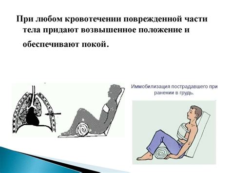 Ранения и кровотечения - презентация онлайн