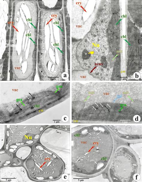 Function Of Palisade Cell Is At Margaret Ratliff Blog