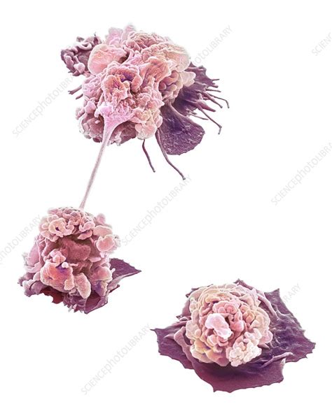 Activated Granulocytes Sem Stock Image C011 1309 Science Photo