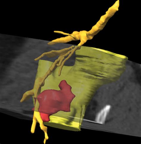 Surgical Neurology International
