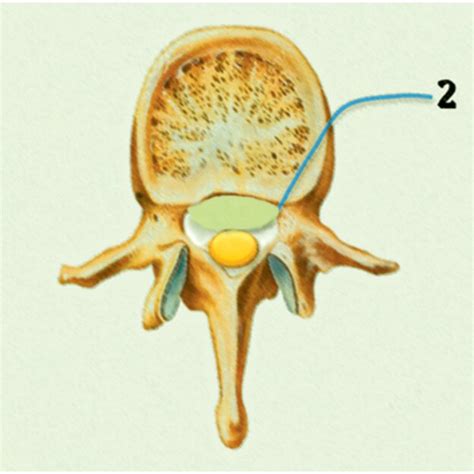 Bilski Classification Of Epidural Spinal Cord Compression Escc Download Scientific Diagram
