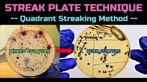 Streaking Technique Quadrant Streaking Bacterial Pure Culture