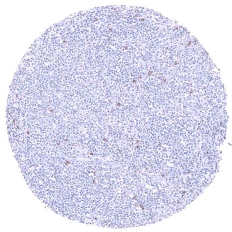 Cancer Tissue Gallery Igd Ms Validated Antibodies