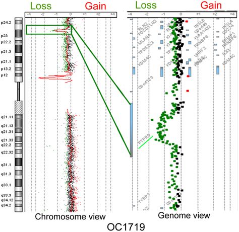 Array Cgh Based Identification Of 9p23 P241 Loss Encompassing Putative