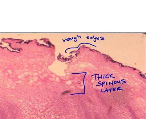 602 Histopathology Flashcards Quizlet