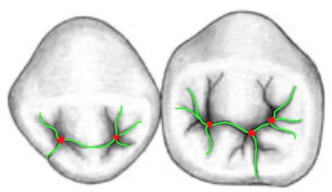 What Is The Occlusal Table At Lewis Wooley Blog