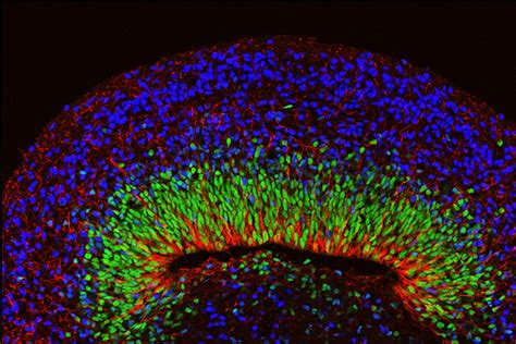 Nature子刊：科学家开发具有复杂神经活动的脑器官 生物通