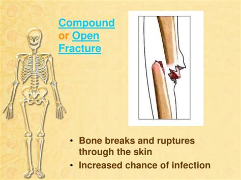 Ppt Skeletal System Powerpoint Presentation Free Download Id4392544