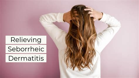 Natural Remedies For Seborrheic Dermatitis Youtube