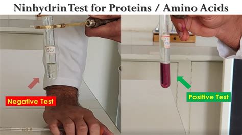 Ninhydrin Test Principle Reaction Reagents Procedure