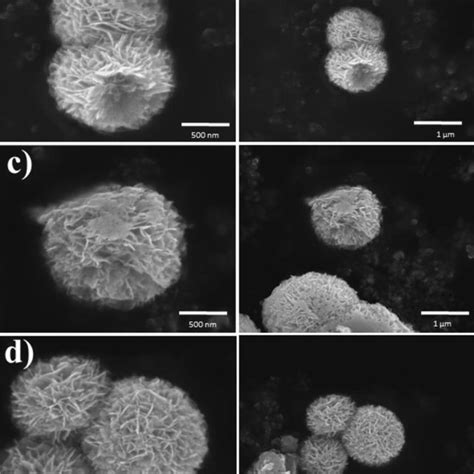 Reticulate Oval Hyperpigmented Patch On The Lower Arm Of A 13 Year Old