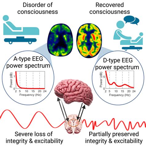 Cerebral Electrometabolic Coupling In Disordered And Normal States Of